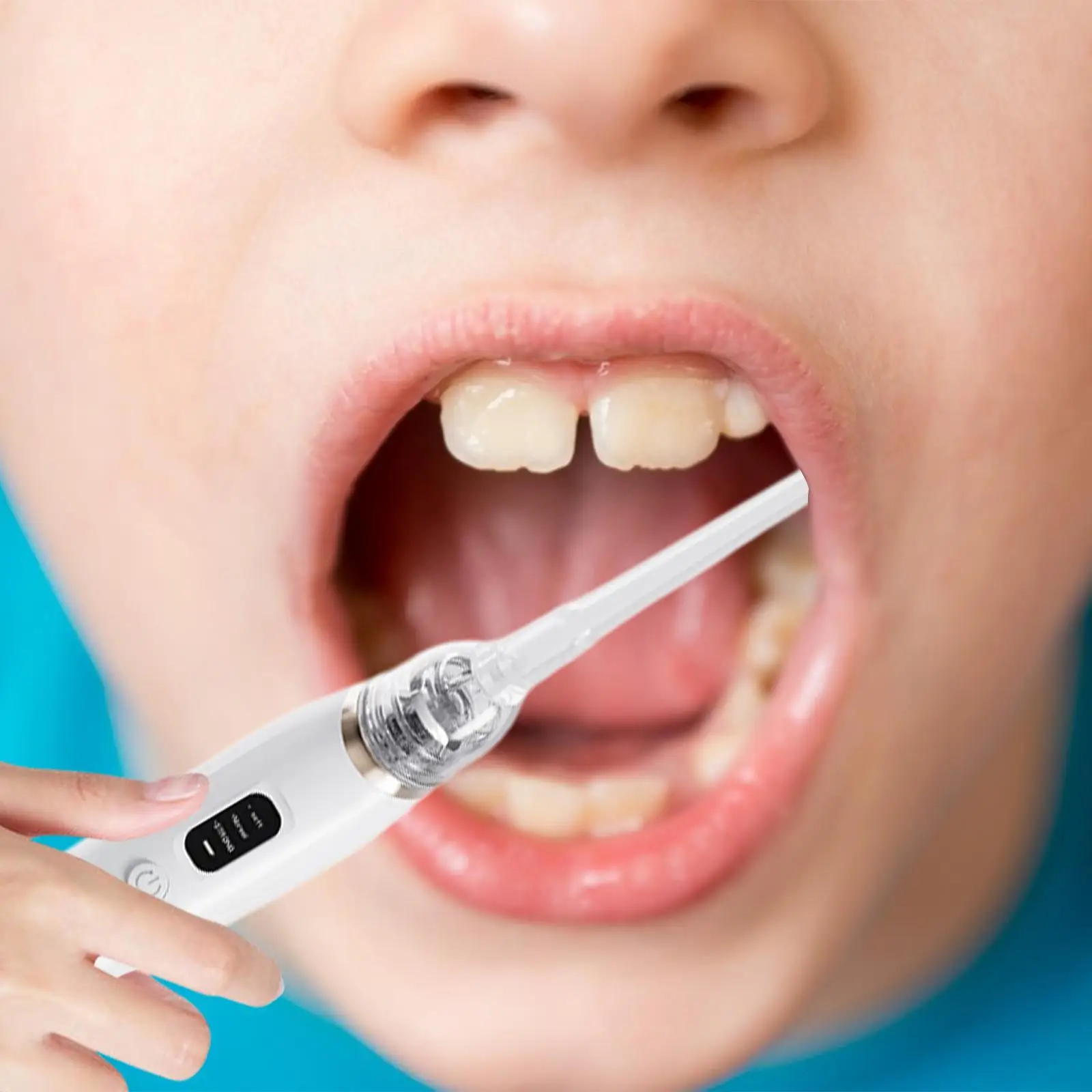 Electric Vacuum Tonsil Stone Remover: Real-World Performance, Safety ...