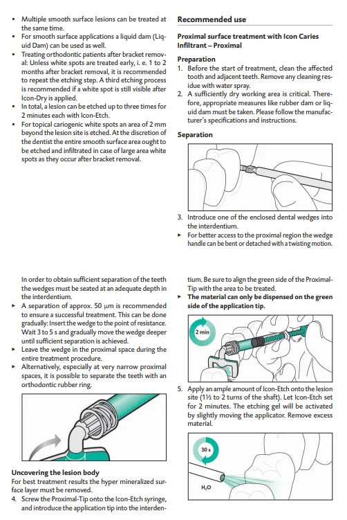 DMG Dental Infiltrant Composite Icon Caries Infiltrant Smooth Surface ...