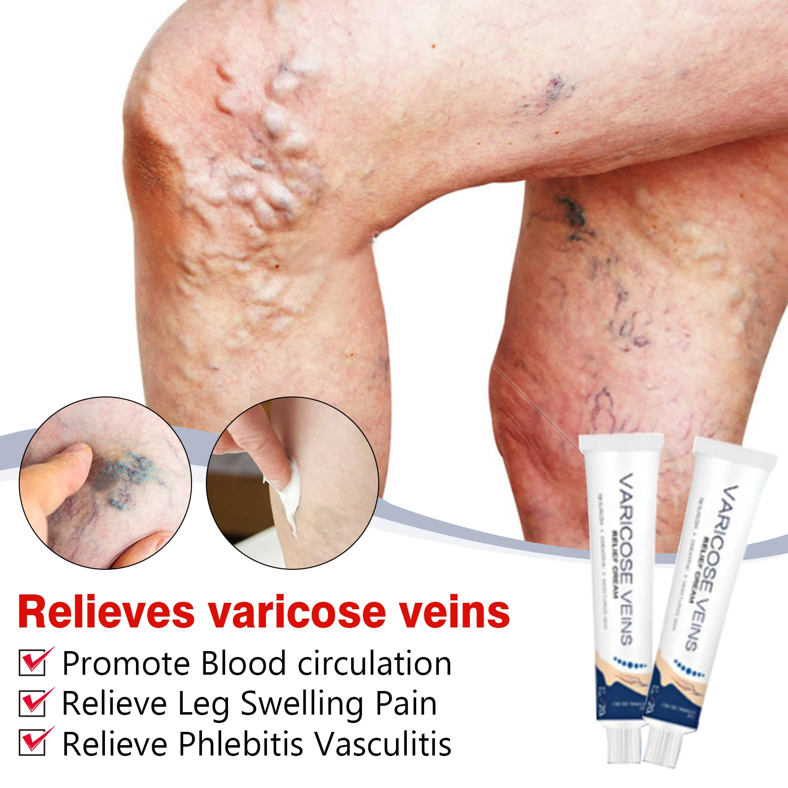 Crema para aliviar las venas varicosas, pomada PARA LA ELIMINACIÓN DE LA angitis, el cuidado del ...