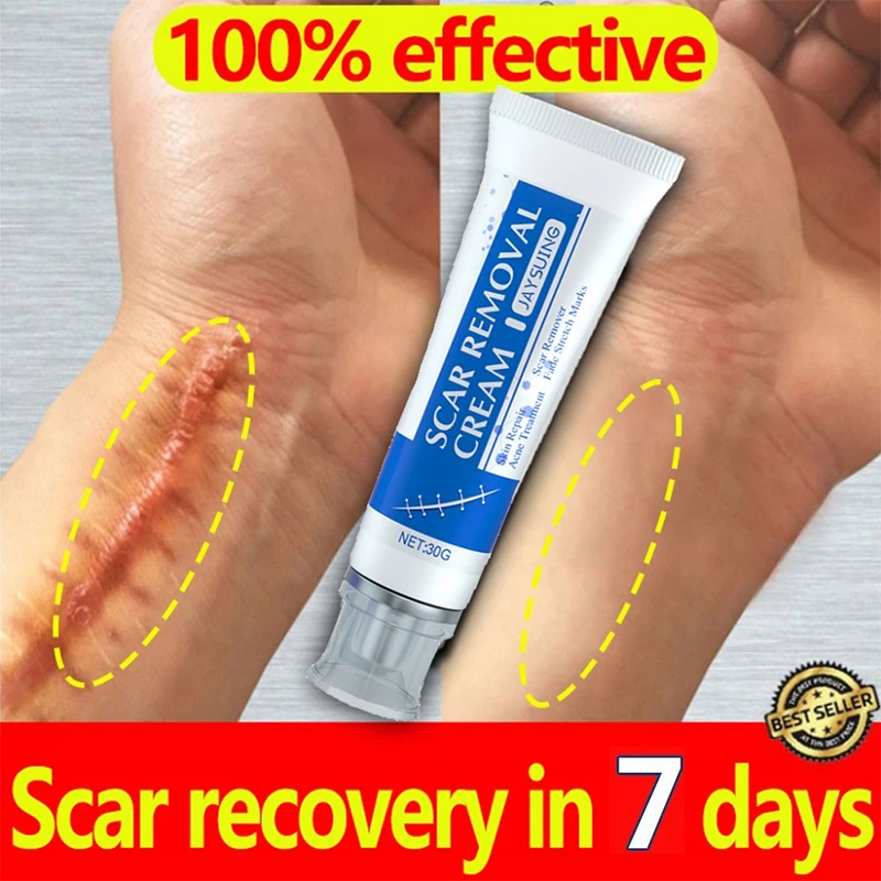 Crema-para-eliminar-cicatrices-en-7-d-as-Gel-de-recuperaci-n-r-pida ...