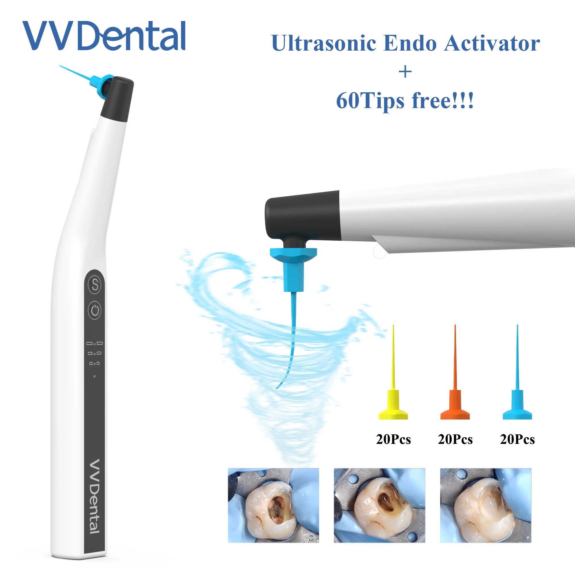 VVD-ental-Oral-LED-Sonic-Irrigator-with-60-Endo-Files-for-Root-Canal ...