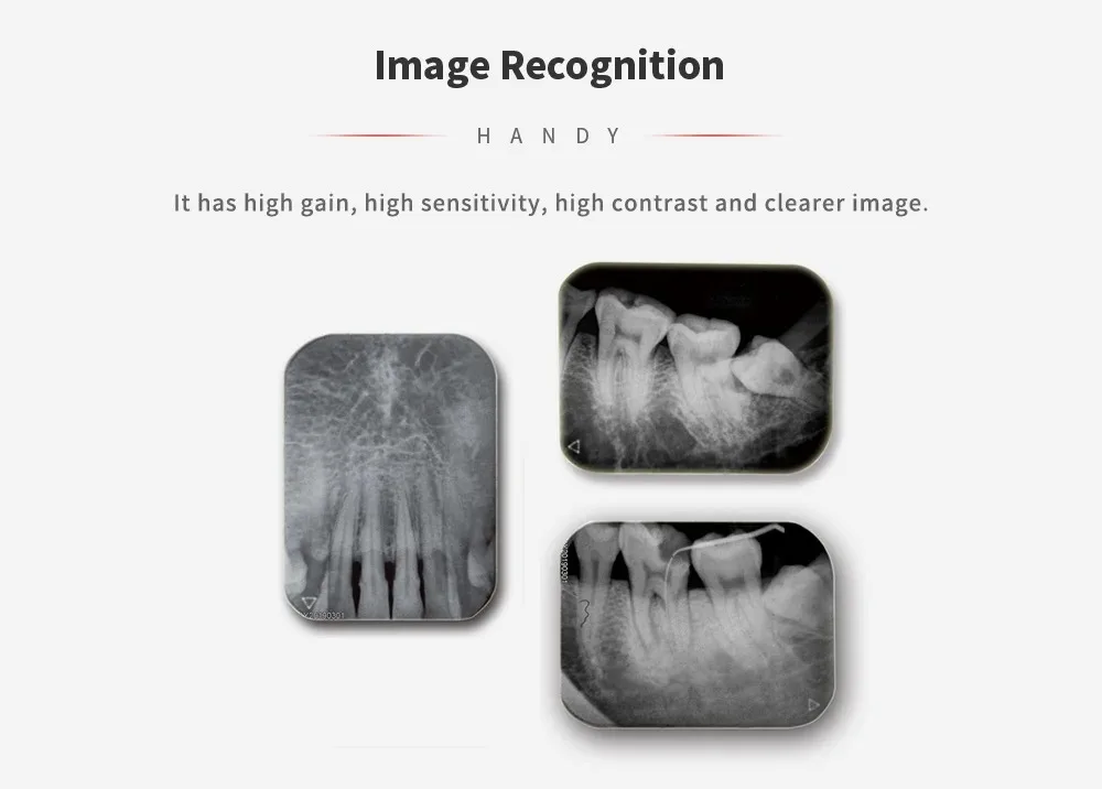 VVDental Dental Sensors Dental Veneers Multiple Size Sensors HD ...