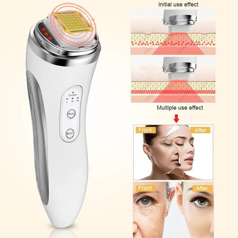 Dot-Matrix-Radio-Frequency-Facial-Lifting-Remove-Wrinkle-RF-Fractional ...