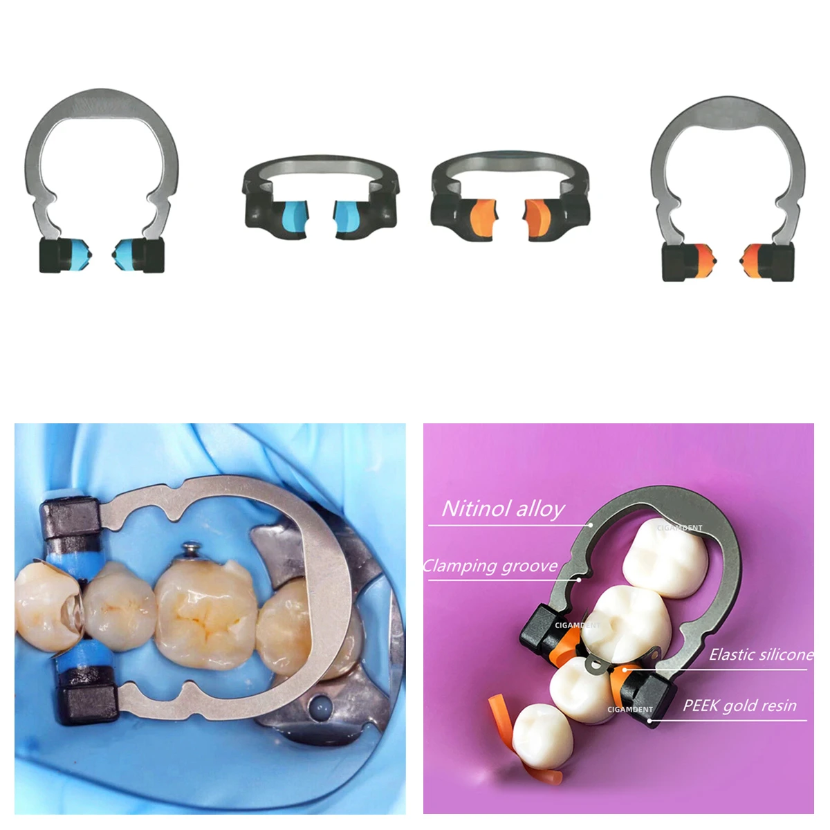 Durable-Dental-NiTi-Matrix-Bands-Ring-Garrison-Style-Matrix-Clamp-Clip ...