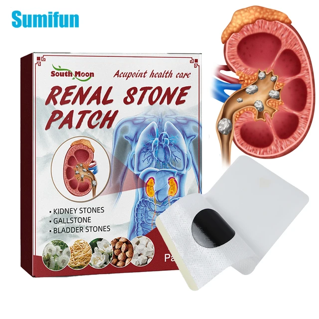 Kidney Stone Pain Relief