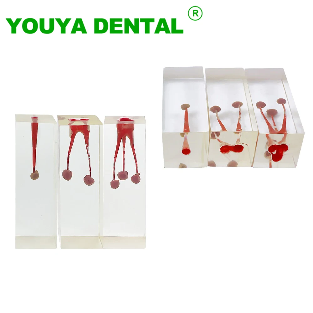 Dental-Tooth-Model-Root-Canal-Block-Practice-Teeth-Pulp-Cavity-Resin ...