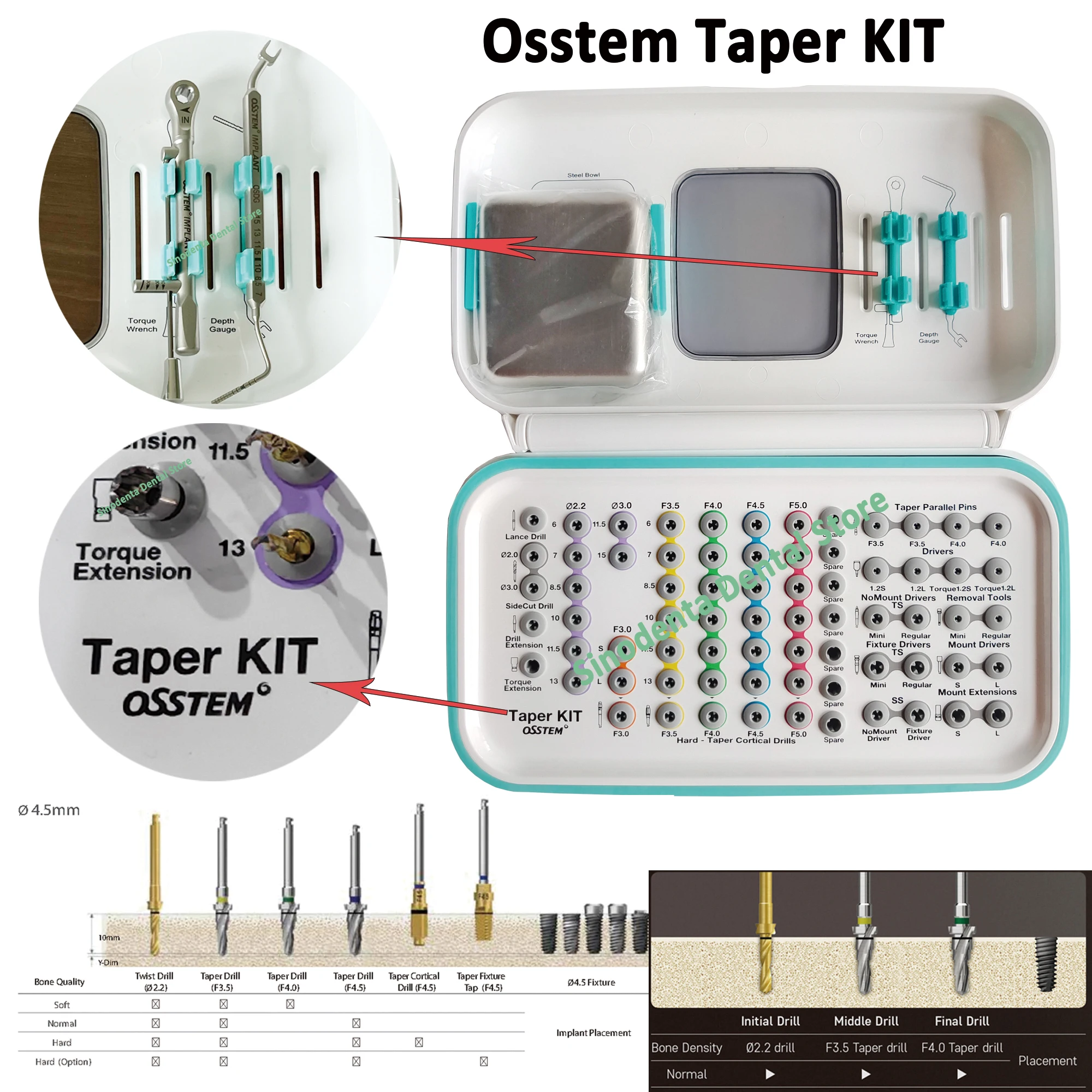 OSSTEM-Kit-c-nico-de-odontolog-a-accesorio-Dental-y-herramienta ...