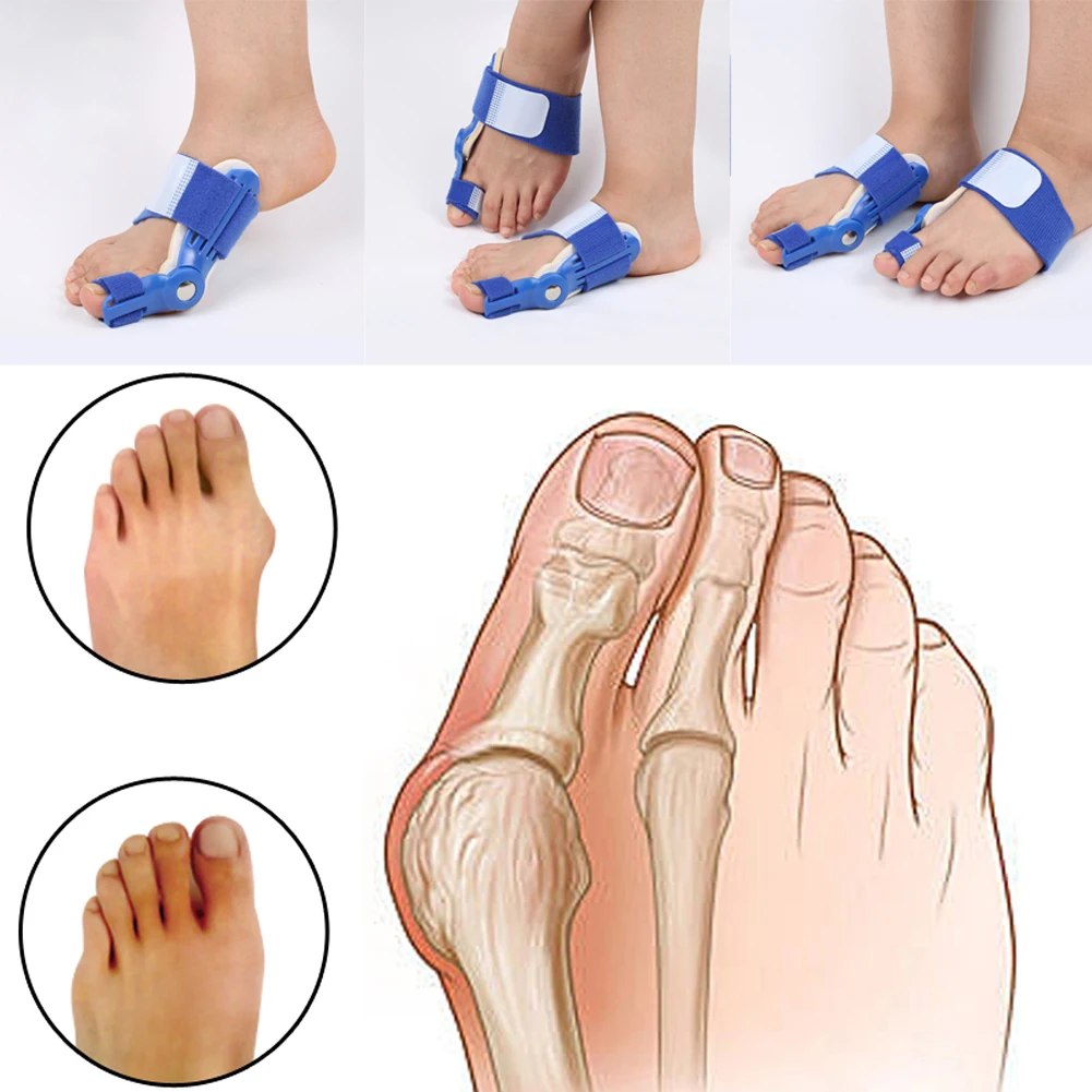 Orthotics Big Toe Corrector Hallux Valgus Foot Pain Relief Feet Guard ...