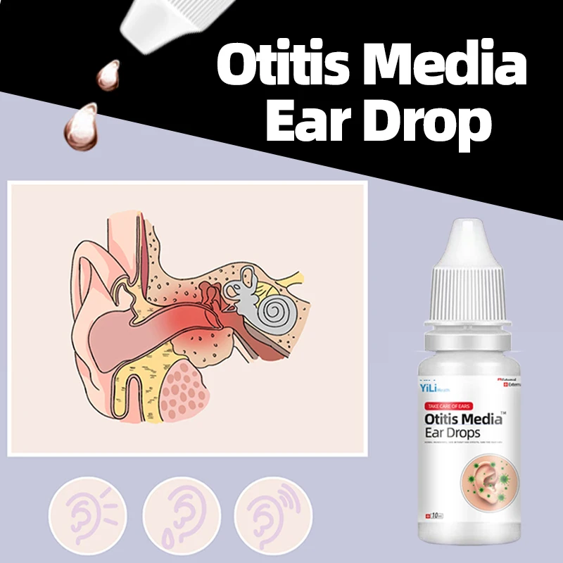 Otitis-Media-Cure-Ear-Drop-10Ml-Ear-Pain-Itching-Acute-Otitis-Bacterial ...