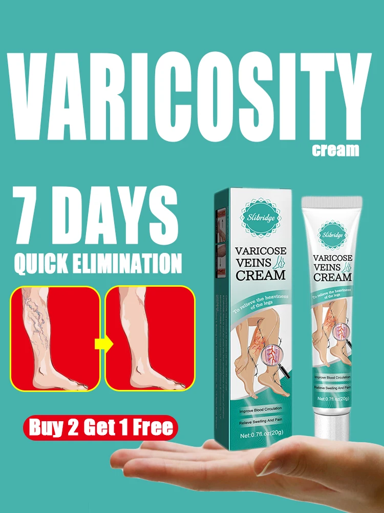 varicosity-cream.jpg