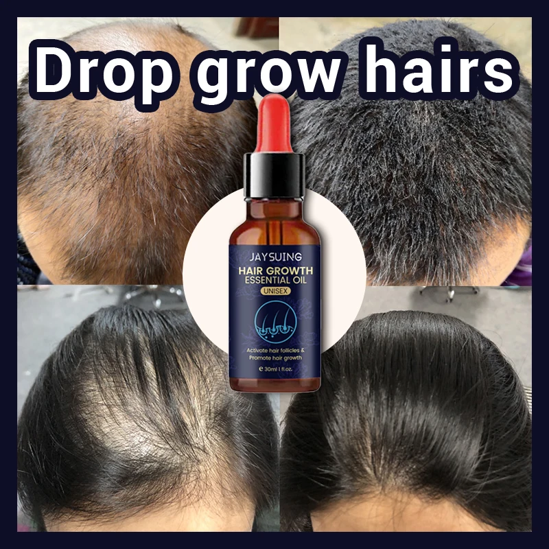 Hair-Growth-Essence-Fast-Hair-Growing-Liquid-Care-Scalp-Hair-Follicles ...