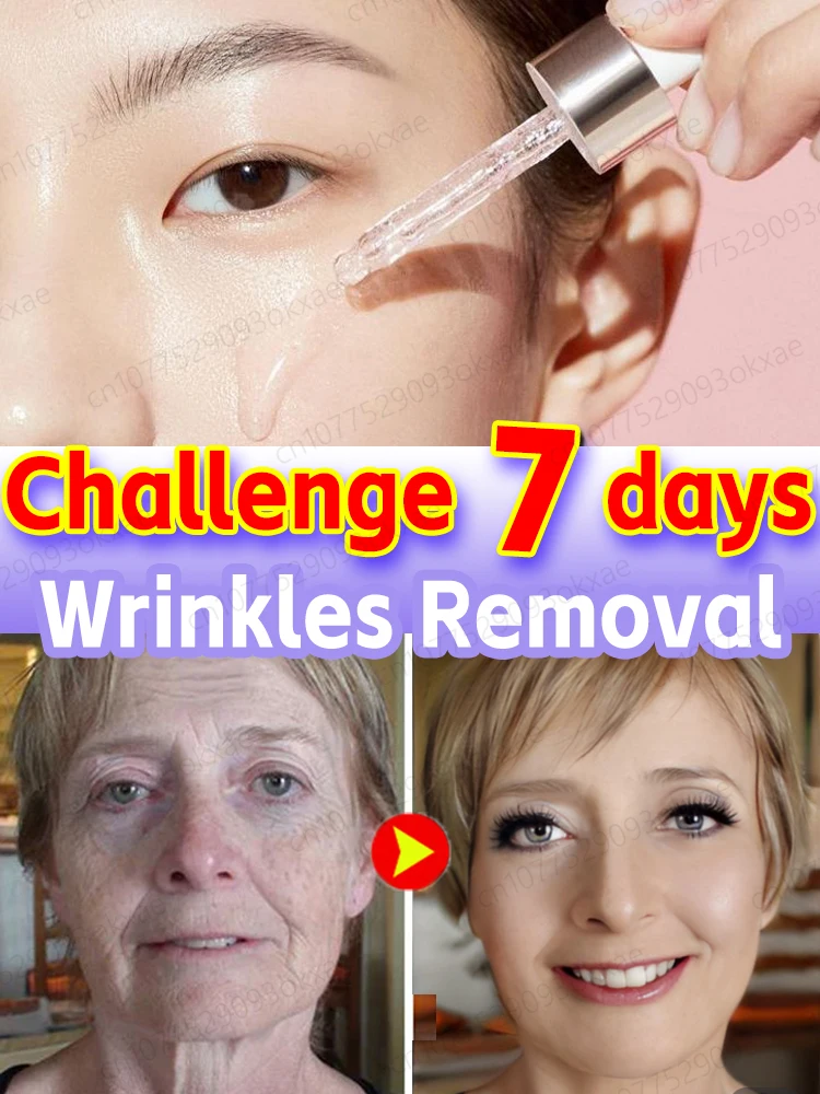 Anti-Falten-Serum-entfernen-Gesicht-Hals-Stirn-Falten-Anti-Aging-Haut ...