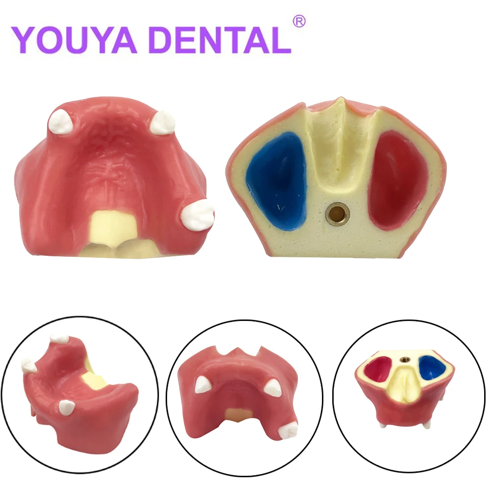Dental-Implant-Teeth-Teaching-Model-For-Dentist-Students-Training-Exam ...