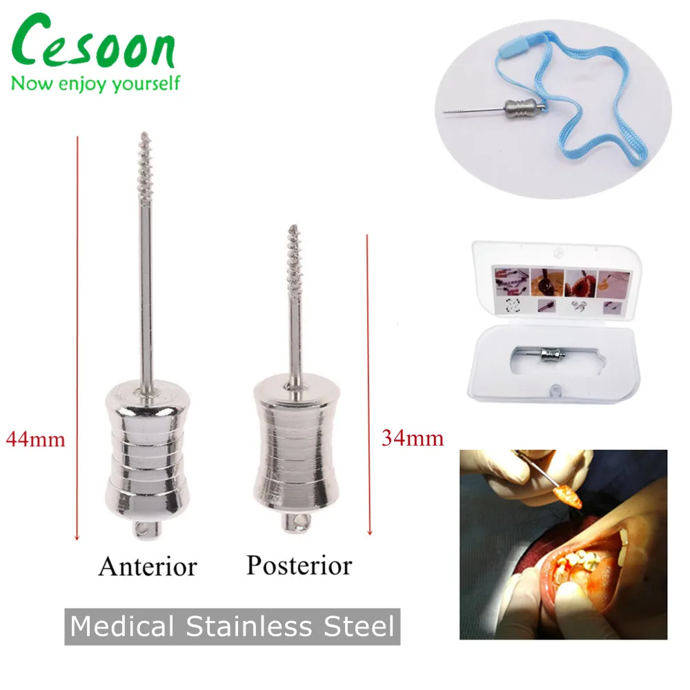 Dental-Broken-Root-Drill-Remnant-Extractor-Teeth-Apical-Root-Fragments ...