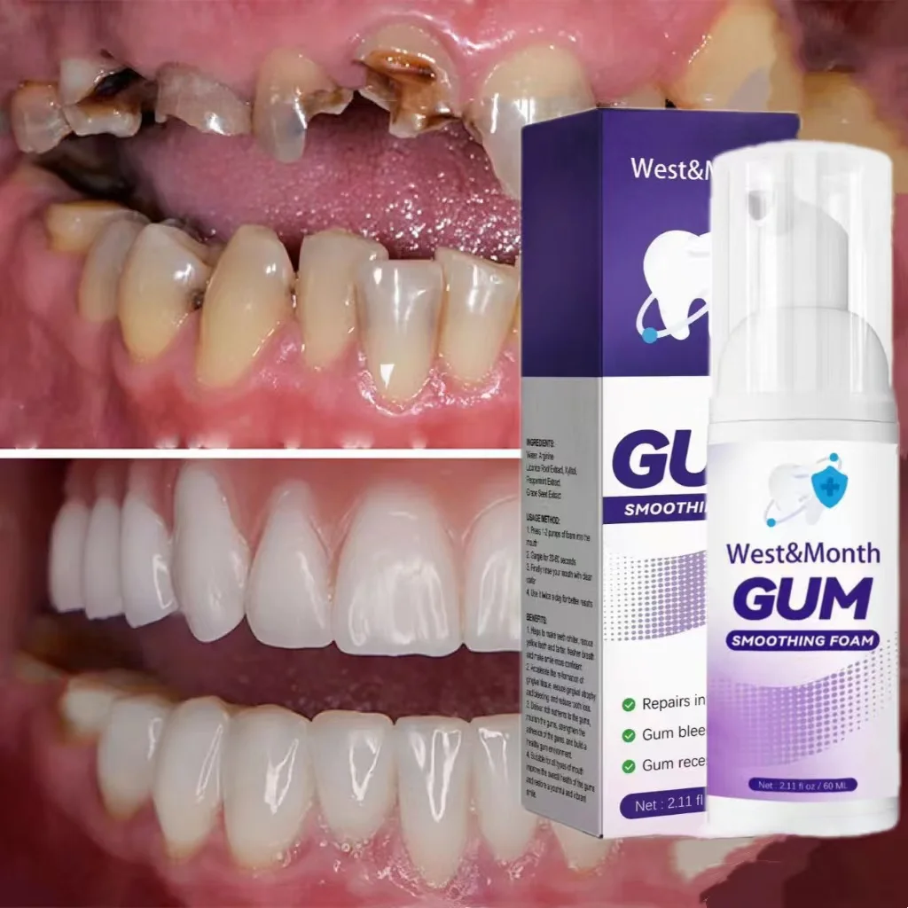 60ml-Tooth-Repair-Toothpaste-Works-To-Treat-Receding-Gums-And-Prommotes ...