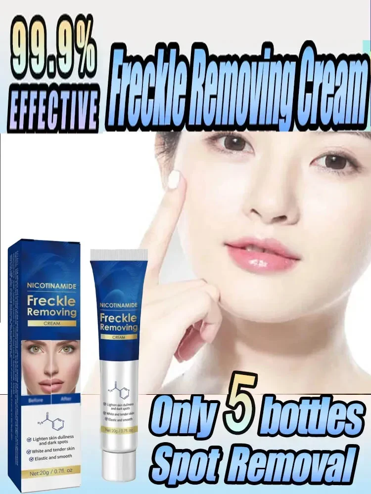 Freckle-Removing-Cream-Lighten-Dark-Spots-Face-Skin-Moisturize-Hydrate ...