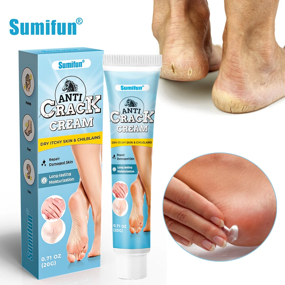 Sumifun-Anti-Crack-Cream-Remove-Hand-Foot-Dead-Skin-Moisturizing ...