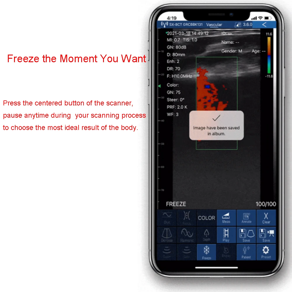 Wireless Handheld Ultrasound Scanner for Full-body Diagnostic - FitMed