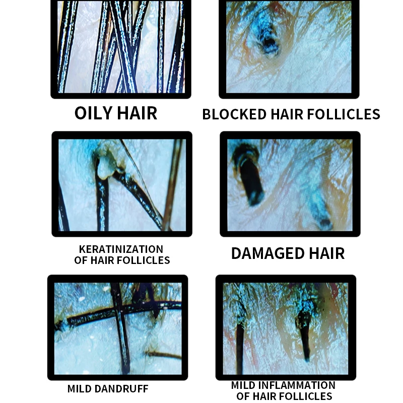 Damaged Hair Magnified