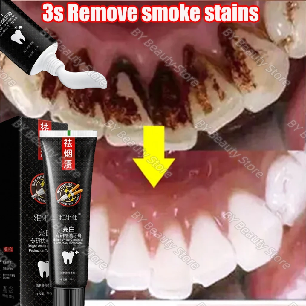 120g-Fast-Remove-Smoke-Stains-Toothpaste-Teeth-Whitening-Pen-Remove ...