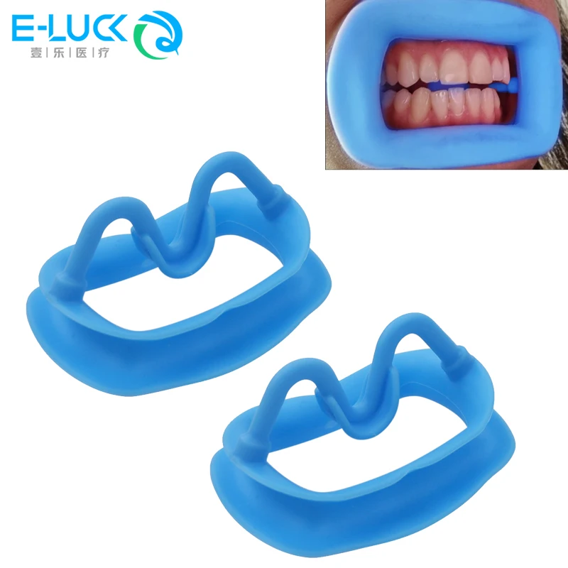 1pc Dental Mouth Open Soft Silicone Orthodontic Cheek Retractor 3D Lip ...