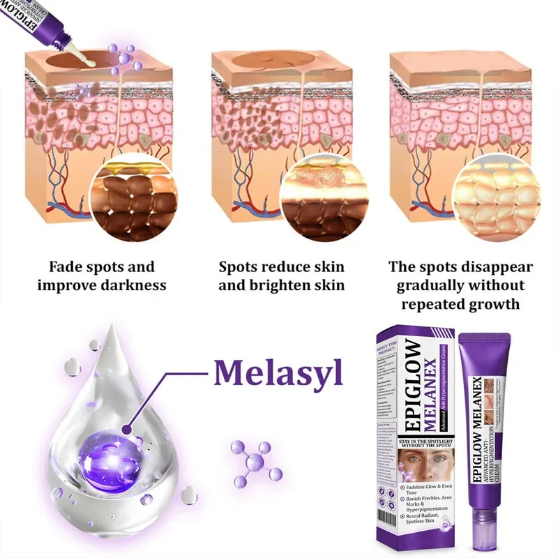 Acid Fast Stain Color: The Ultimate Guide to Effective Pigmentation ...