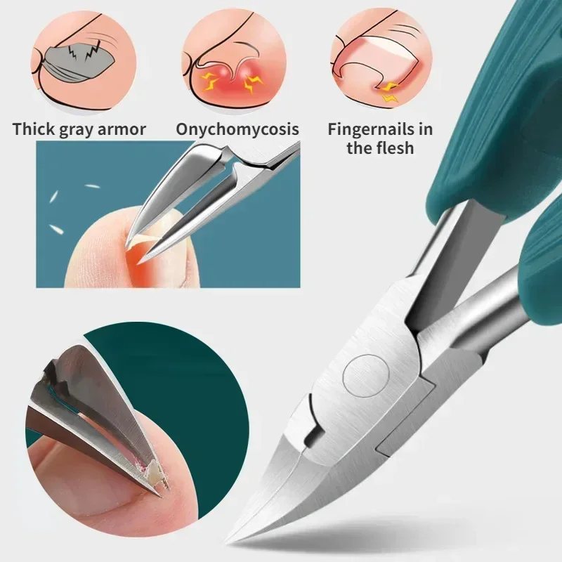 Thick Nail Ingrown Nippers Toe Nails Clippers Nail Correction Dead Skin ...