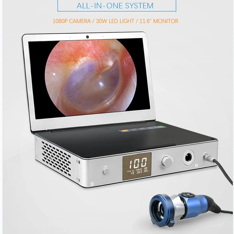 3 in 1 Portable HD 1080P Medical Endoscopy Camera with 11.6 inch ...