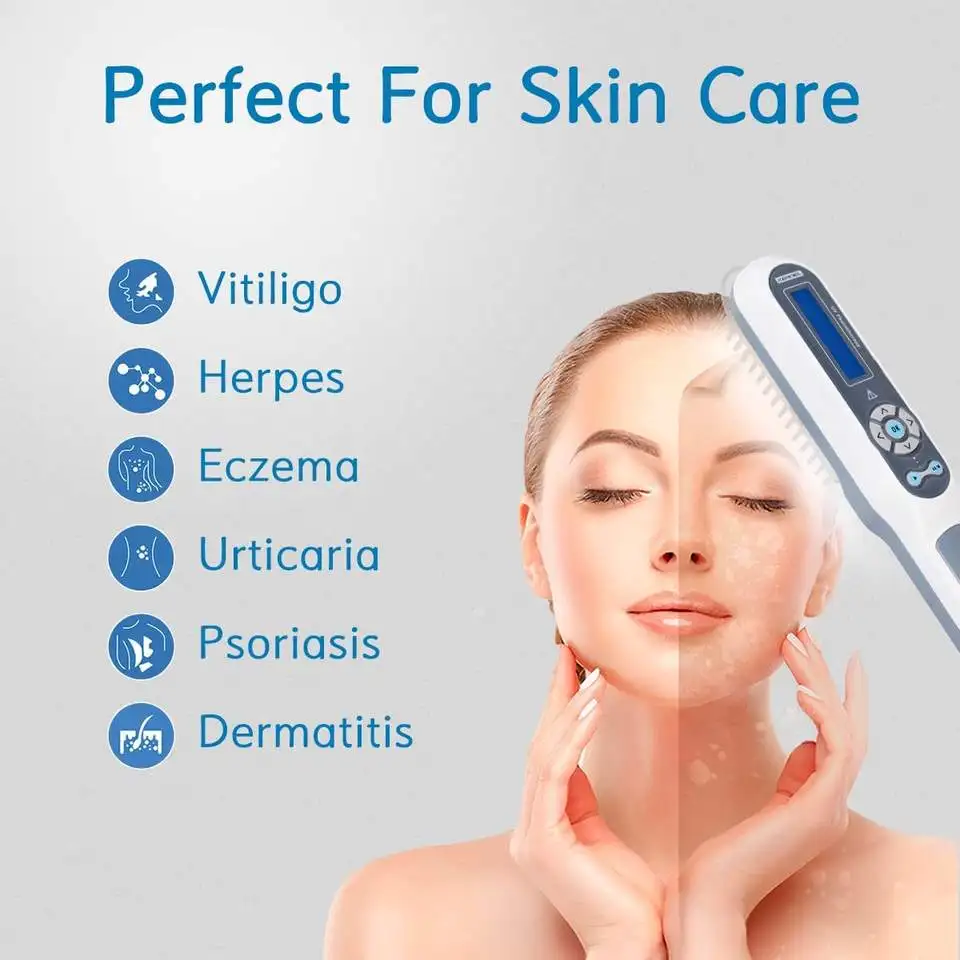L-mpara-de-banda-estrecha-para-fototerapia-UVB-311nm-311-UVB-para-tratamiento-de-Vitiligo.jpg
