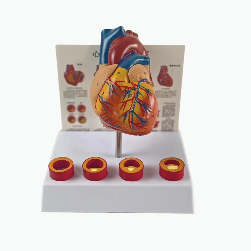 Removable Anatomical Human Life Size Heart Medical Cardiovascular ...