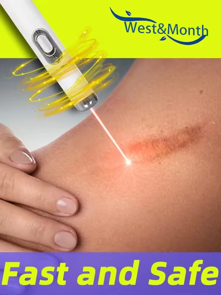 Laser-therapy-Keloid-scar.jpg