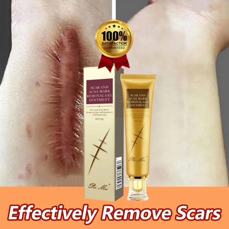 Effective Itchy Scar Treatment Solutions for Faster Healing and Skin ...