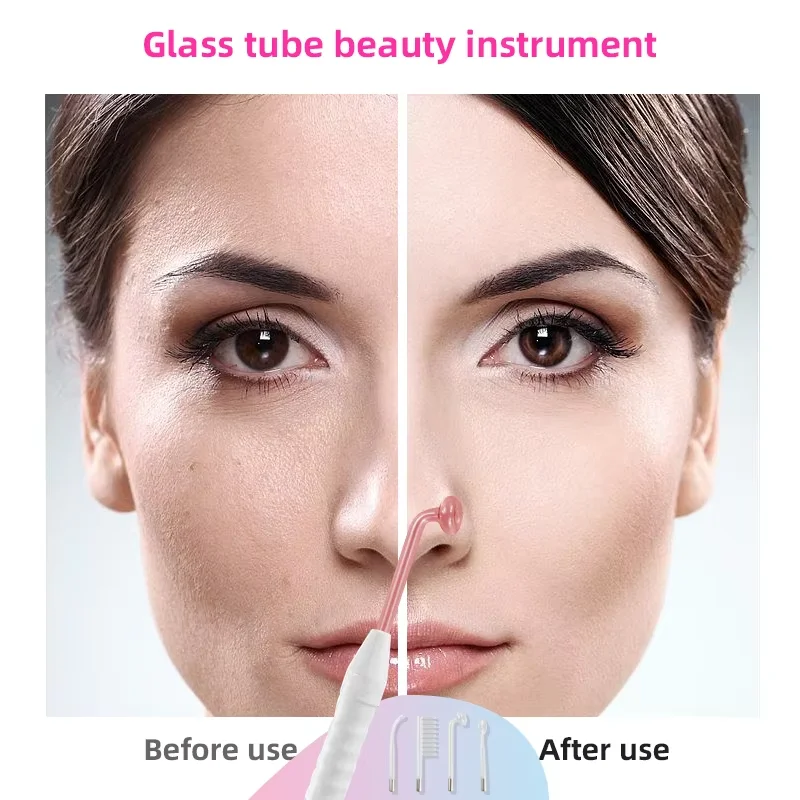 High-Frequency 4-in-1 Skin Care Wand for Acne and Facial Treatment (EU ...