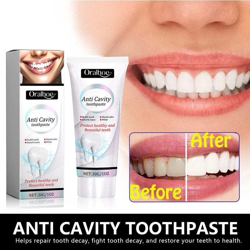 Anti-Yellow-Toothpaste-Deep-Cleaning-Tartar-Decaying-Fresh-Breath ...