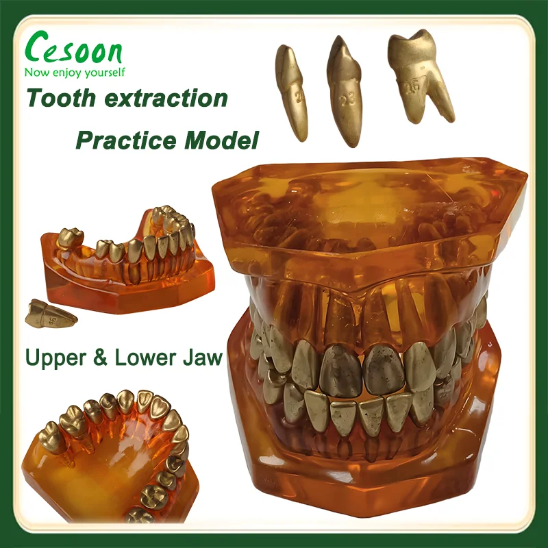 28 Teeth Model For Dental Orthodontic Tooth Extraction Practice Jaw ...