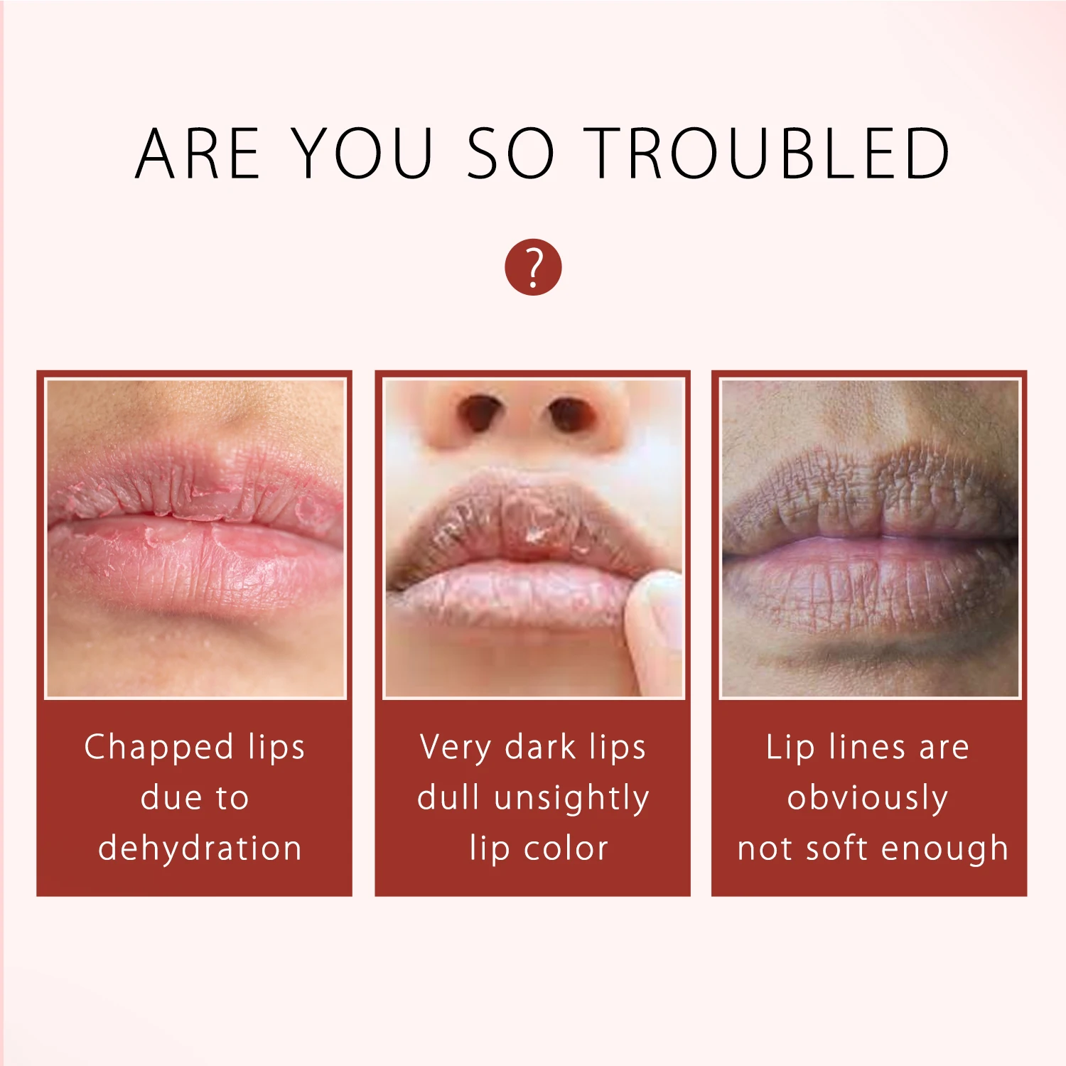 Cracked Lips Dehydration