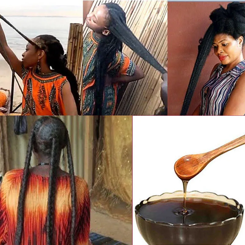 300ml 2 mês super rápido crescimento do cabelo shampoo combinando ...