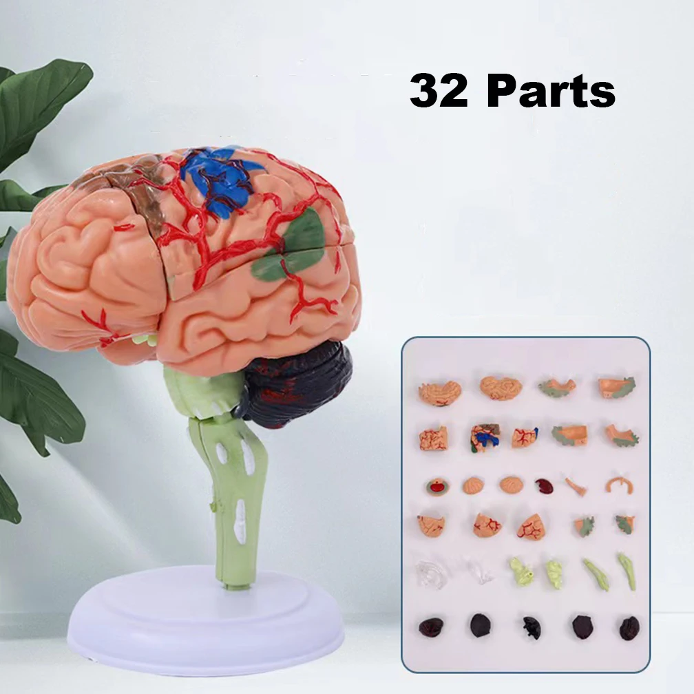 4D-Disassembled-Anatomical-Human-Brain-Model-Anatomy-Medical-Teaching ...