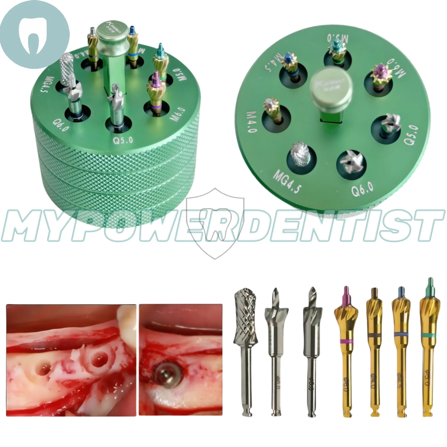 Dental Implant Bone Profiler Dental Ridge Contouring Drills Trimmer ...