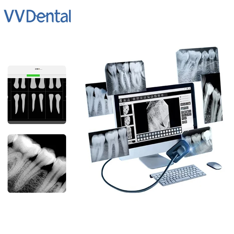 VVDental-Dental-RVG-Sensor-X-Ray-Radiovisiograph-High-Frequency-Digital ...