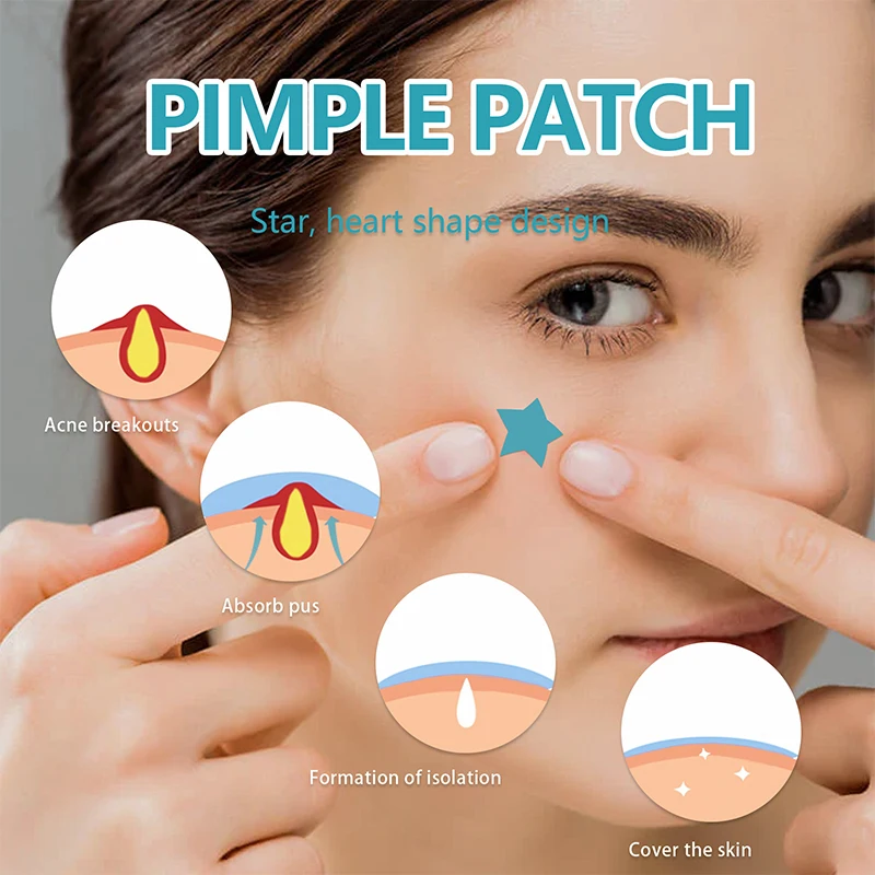 216Pcs-Acne-Pimple-Patch-Sticker-Waterproof-Acne-Treatment-Pimple ...