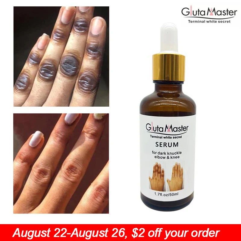 Get Rid Of Dark Knuckles In 7 Days Serum Whitening Knuckle Removal Oil ...
