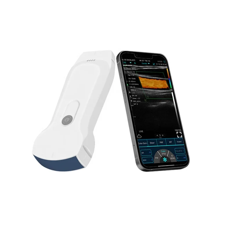 wireless-wifi-ultrasound-scanner-probe-3-in-1-color-portable-doppler ...