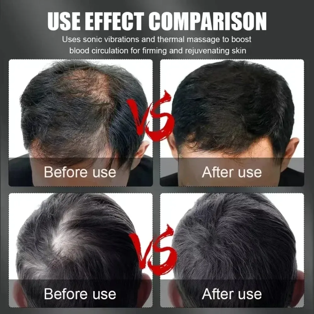 Hair Growth Cap Anti Hairs Loss Scalp Care Relieve Fatigue Strengthen ...