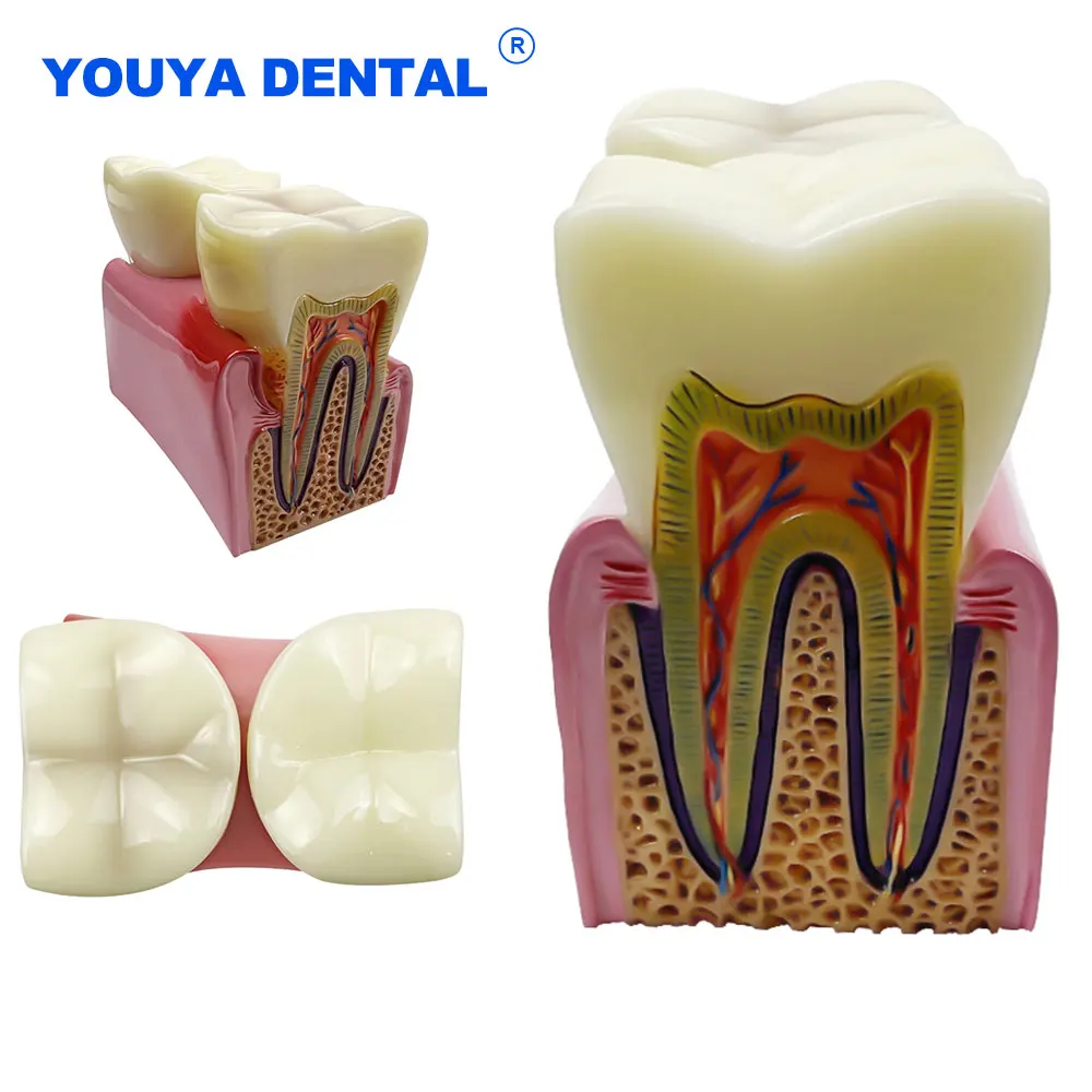Large-Comparation-Teeth-Model-Study-Anatomy-Models-Denture-Tooth-Decay ...