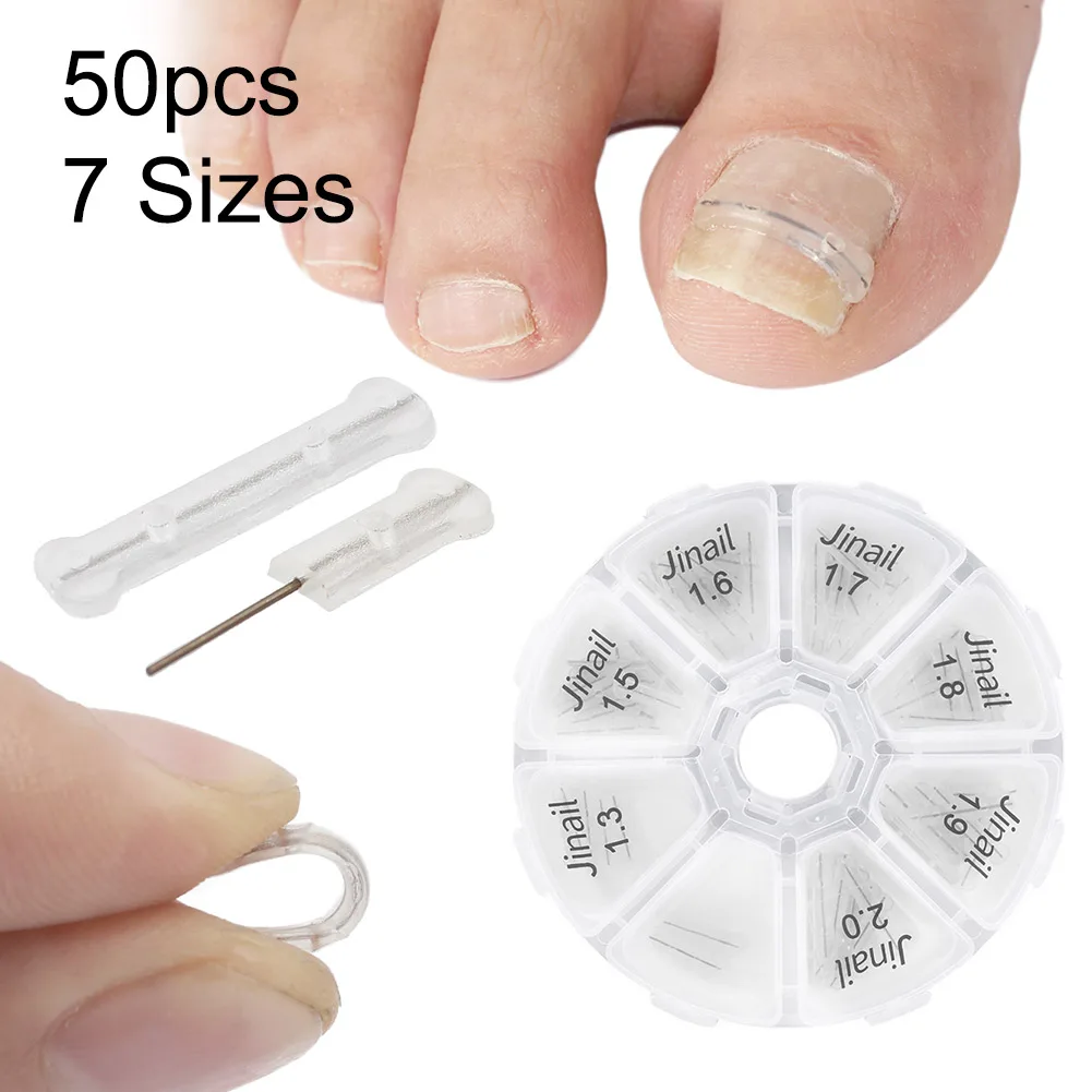 50pcs-Nail-Correction-Stickers-Titanium-Wire-Silicone-Ingrown-Toenail ...