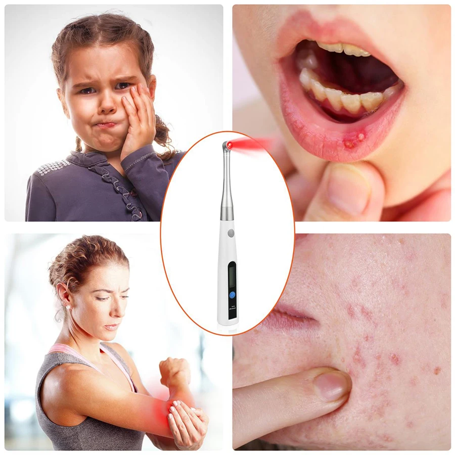 Cold Sore Laser Therapy Device Light Therapy Mouth Ulceration Blisters ...