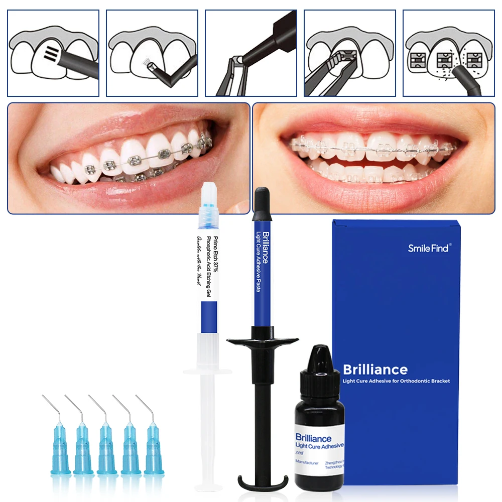 Dentist-Dental-Orthodontic-Adhesive-Set-Light-Cure-Metal-Ceramic ...
