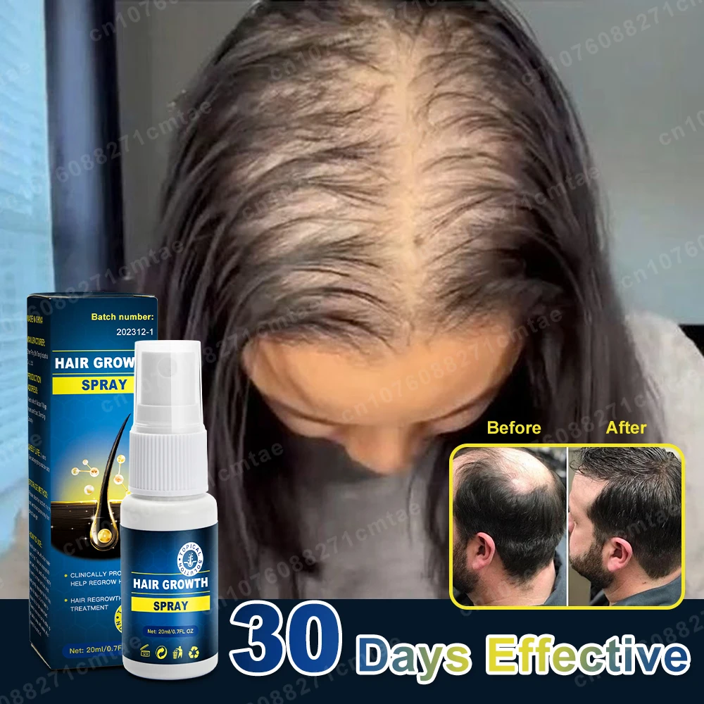 Fast-Hair-Growth-Products-Hair-Growth-Spray-for-Men-Women-Repair ...