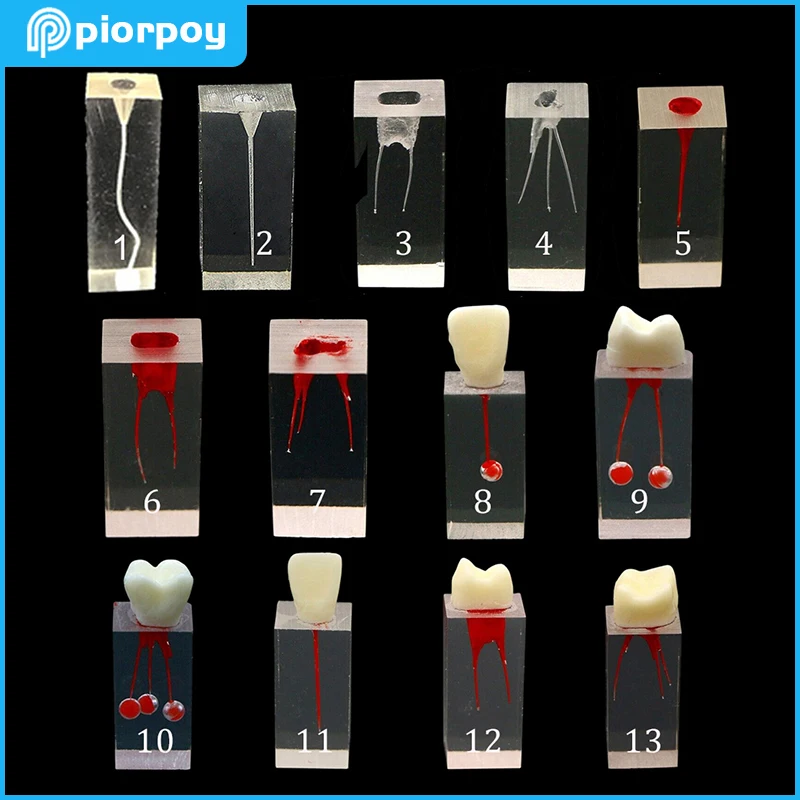 Dental Root Canal Block Teaching Model Endodontics Training Tooth Model RCT Practice Pulp Cavity ...